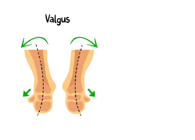 SOCIÉTÉ WOLLENSCHNEIDER - Podo-orthésiste / Orthopédie sur mesure